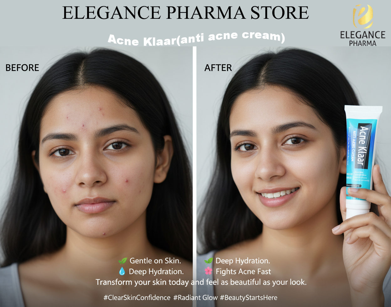 Top 10 tips for acne-prone skin in Pakistan – Elegance Pharma Store